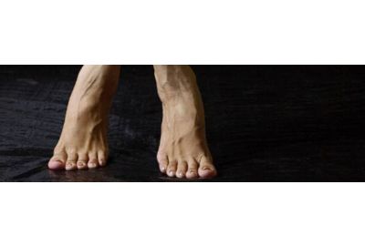 Tromboza: simptome, tipuri de tromboza si optiuni de tratament