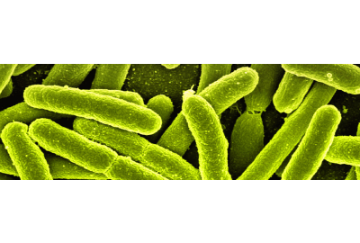 Infectia cu bacterii din genul Listeria: Cum apare, cum se trateaza si ...