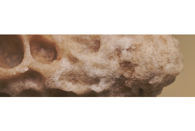 Mastocitoza: de ce apare boala, cum se manifesta si cum se trateaza ...