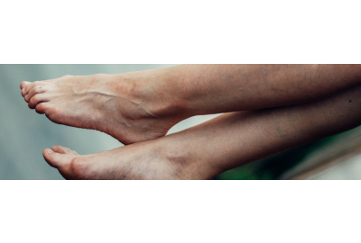 Metatarsalgia: Cum apare boala, simptome si cum poti evita durerea de ...