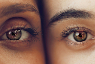 Pete rosii sub ochi: semne, cauze si strategii de ingrijire