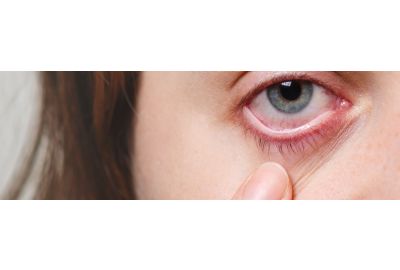 Blefarita: Cum apare si cum se poate trata, moduri de preventie