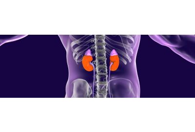 Ce este Litiaza renala?