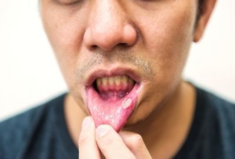 Diferenta dintre ulcer si gastrita. Ce trebuie sa retinem