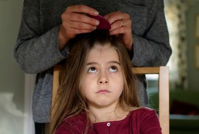 Mituri despre infestarea cu paduchi - pediculoza