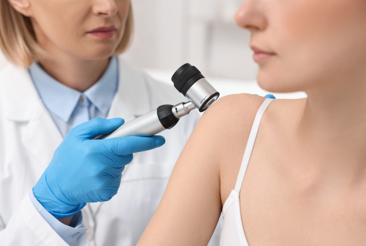 Ghid complet despre carcinomul bazolcelular